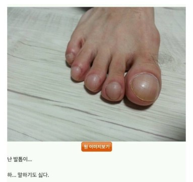 특이점이 온 발톱 - 스카이파크