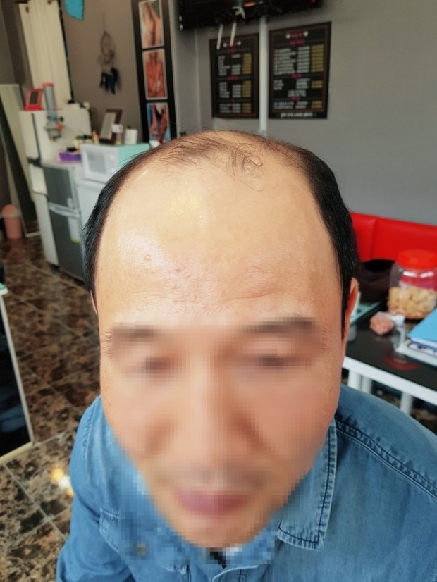 써니얼굴 - 스카이파크