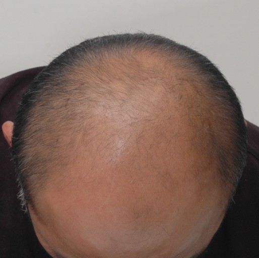 안녕하세요 빵순입니다 - 스카이파크